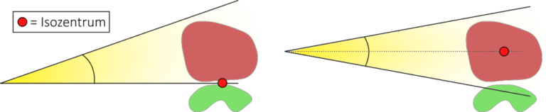 Bestrahlungstechniken · Medizinische Physik
