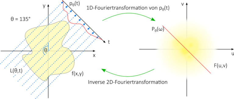 Computertomographie (CT) · Medizinische Physik